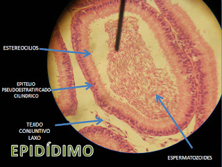 MÉDECINE: EPIDIDIMO - HISTOLOGÍA