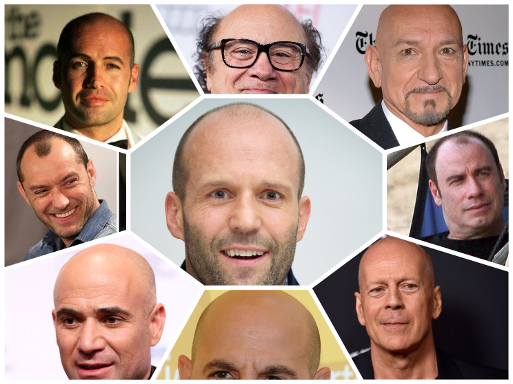 Man Talking Man Stuff!!!: Thinning On Top?!