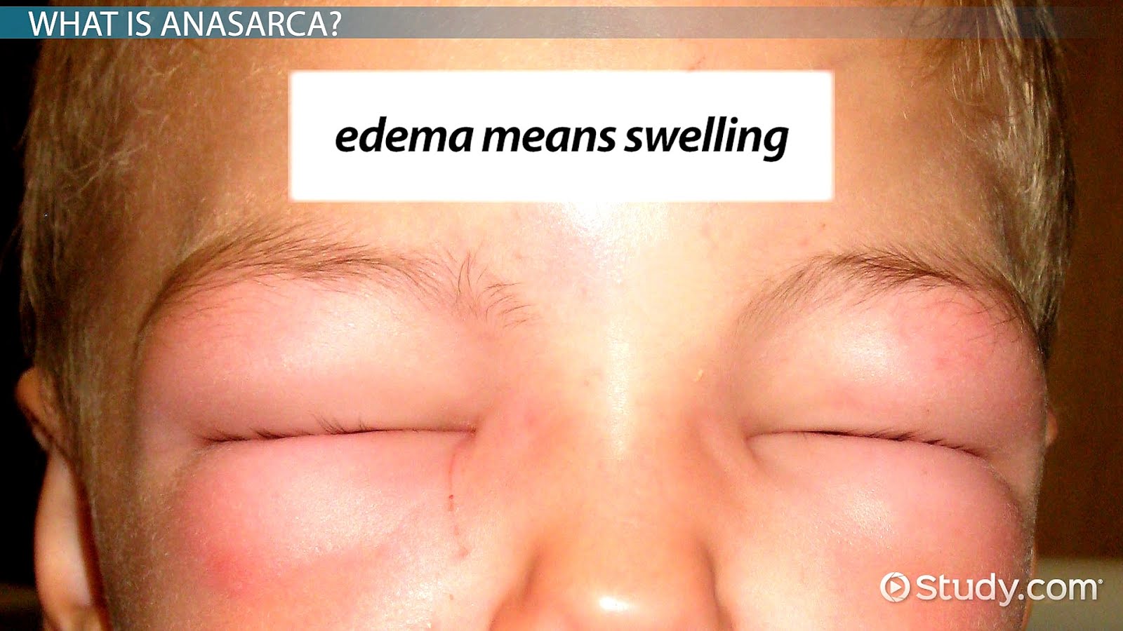 What Does Cma Mean In Medical Terms Medi Choices what-does-cma-mean-in-medical-terms-medi-choices