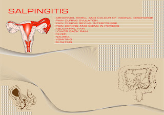 Physio knowledge BD: Salpingitis