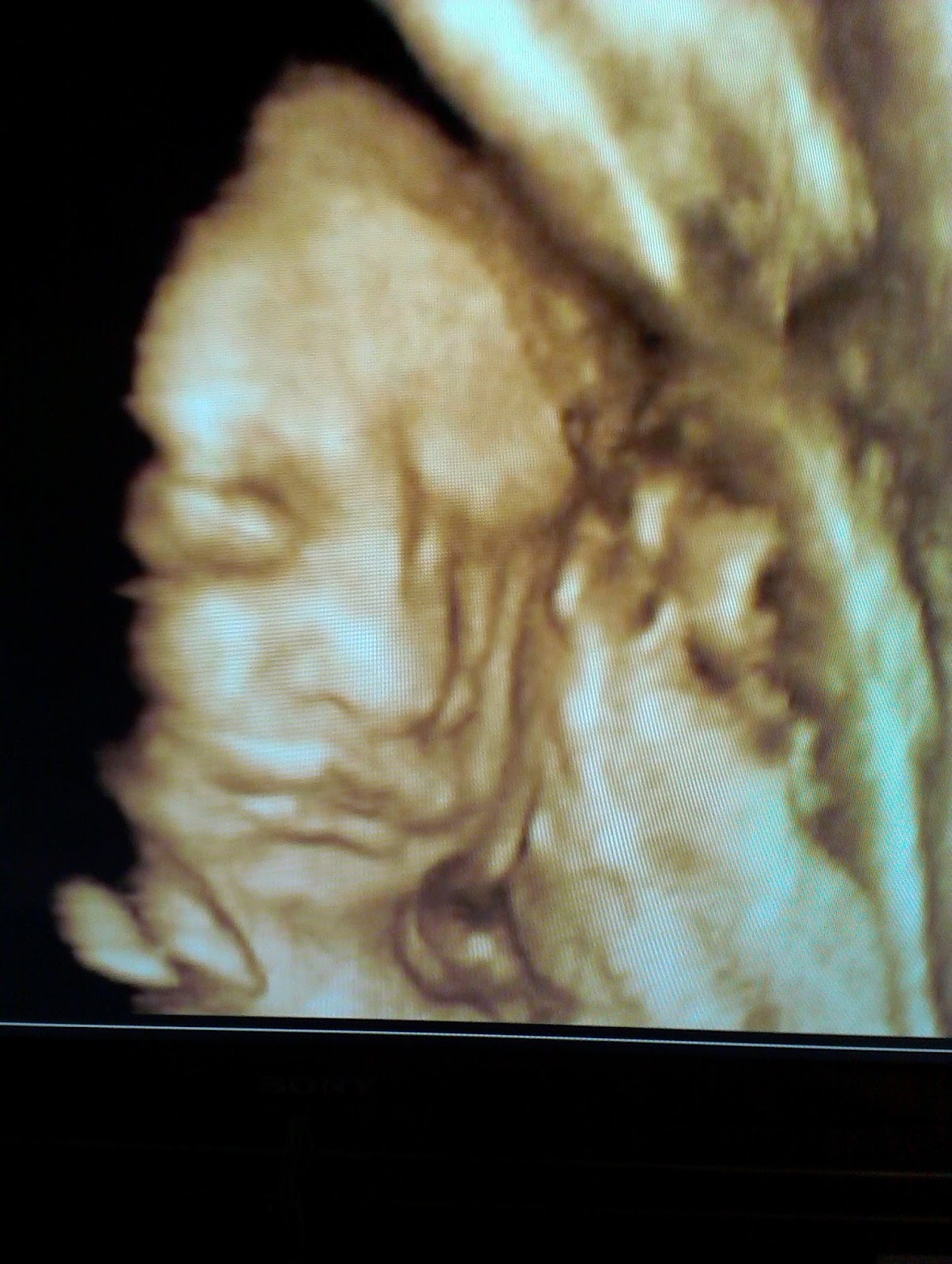 AnnaleighNicolePascal: Pregnancy Series:Our 3D Baby Scan