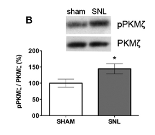 The Boundless Thicket: Erasing Memories With A Pill