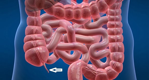 Apendicite: Sinais, sintomas e tratamento