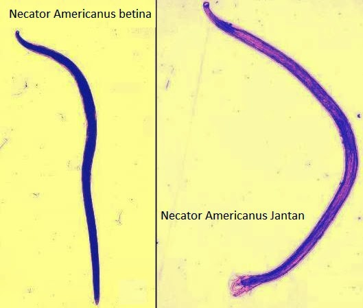 Necator Americanus dan Ancilostoma Duodenale | Sehat Online