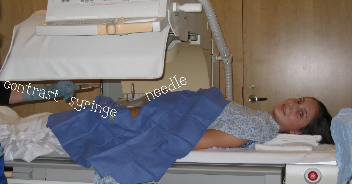 highschool and hip surgery: MRI arthrogram- pictures!