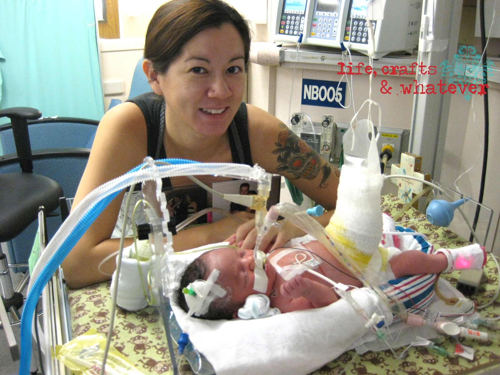 Life Crafts & Whatever: Gastroschisis Awareness Day is coming up