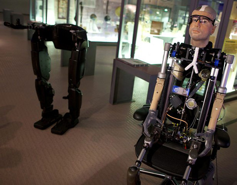 El increible y real hombre biónico - Toluca Noticias | De Hoy