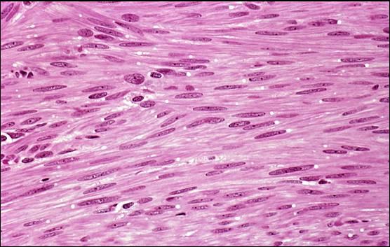 Sistemul Muscular: Sistem Muscular