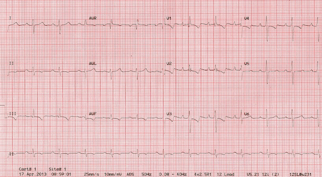 Symphony of Electrocardiography: 25 year old male with SOBOE