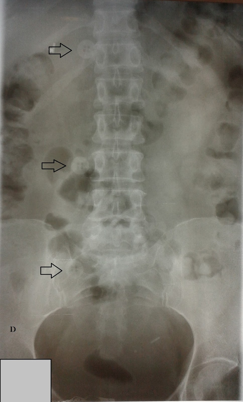 DICAS DE RADIOLOGIA - Tudo Sobre Radiologia: IMAGENS RADIOLÓGICAS ...
