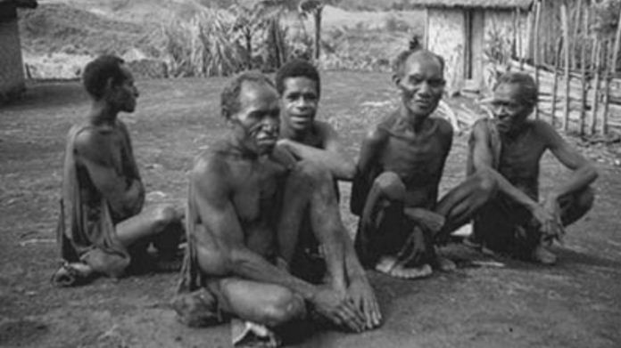 Ada dugaan penyakit kuru pada manusia terkait dengan praktik ...