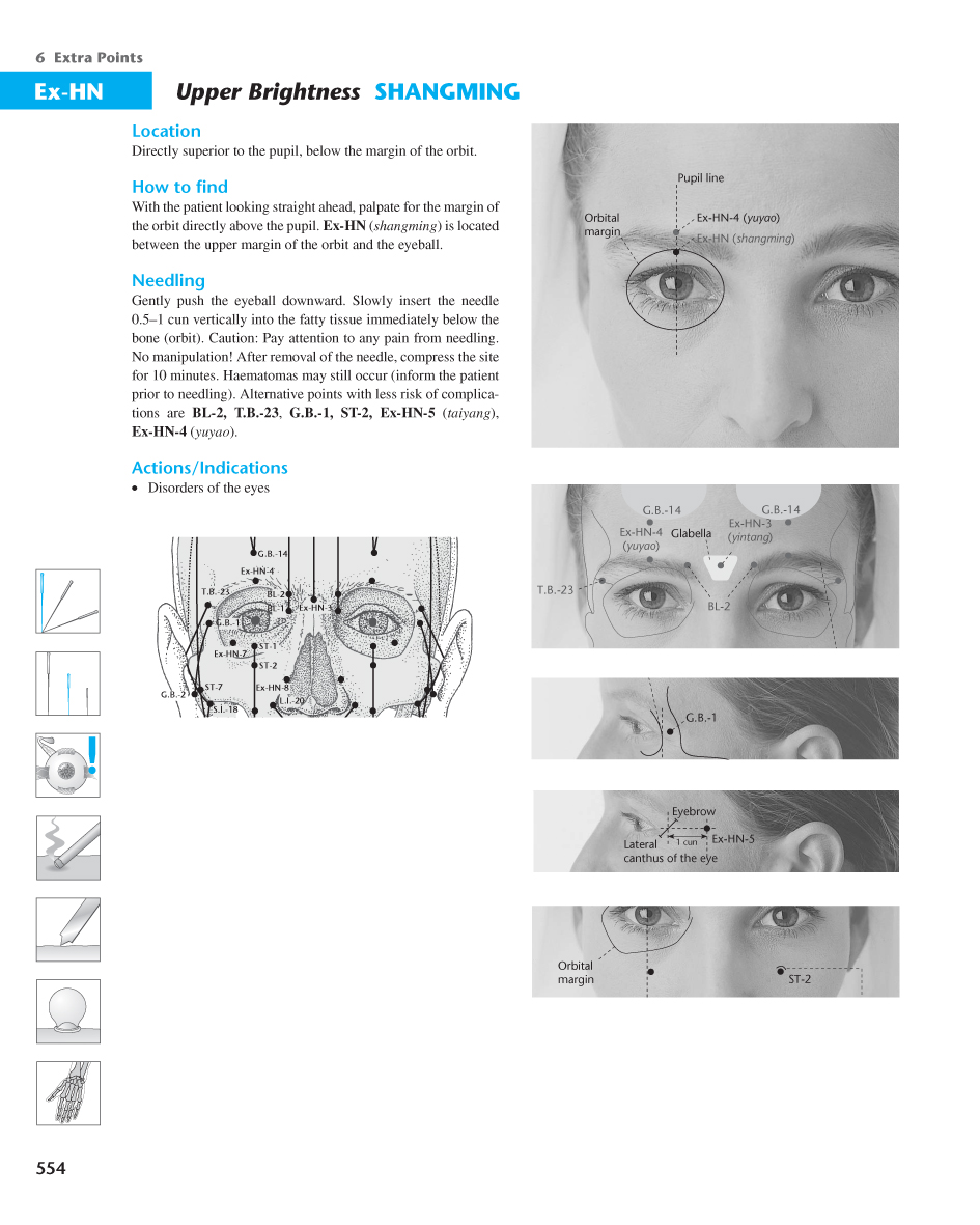Acupuncture Masters: Acupuncture Points Database - Extra Points