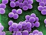Bakteri Staphylococcus aureus | Informasi Kesling
