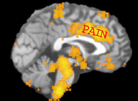 The Neurocritic: Social Pain Revisited: Opioids for Severe Suicidal ...