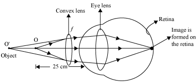 The Science Week: Defects Of Vision- Simplified Notes