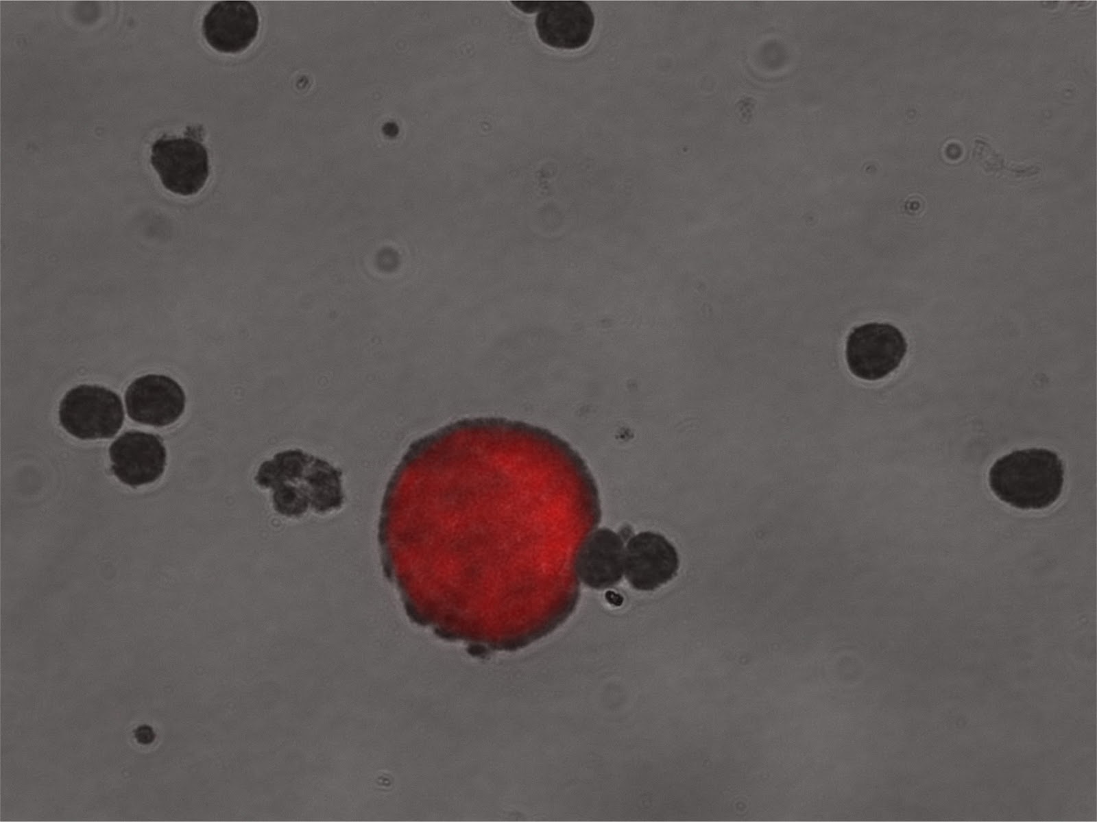 Actualités Scientifiques - Médicales: Cellules tumorales circulantes et ...