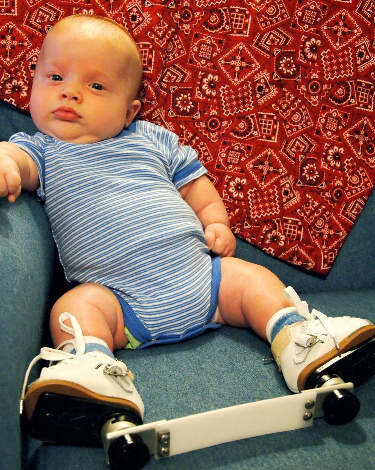 Hablemos de Torsion Tibial - Ortho Techs Mexicali