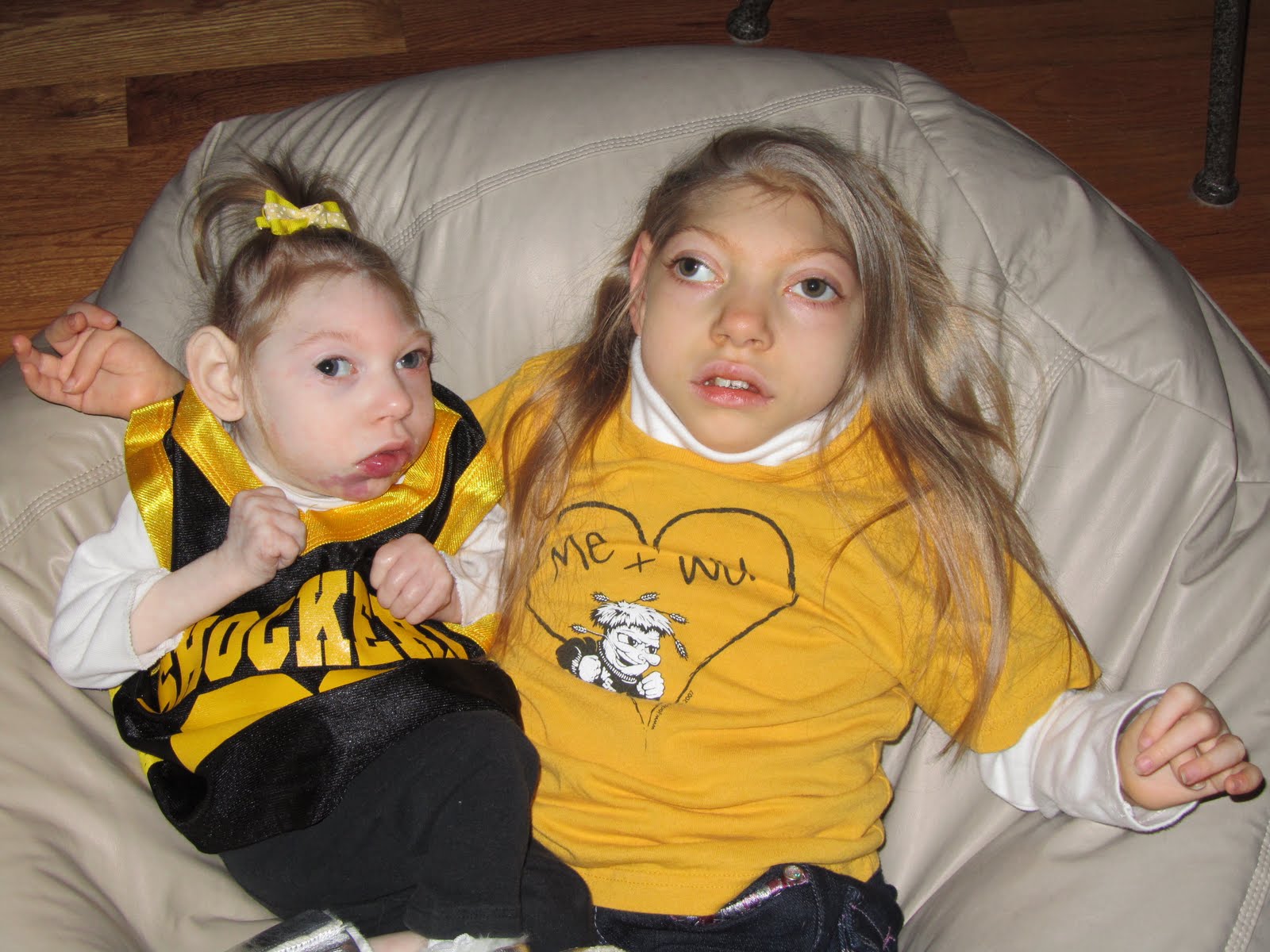 The Hartley Hooligans: Locks of Love?!