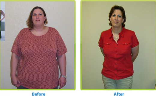 Quick Weight Loss 10 Questions To Ask Before Weight Loss Surgery quick-weight-loss-10-questions-to-ask-before-weight-loss-surgery