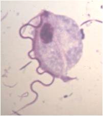 Microbiologia y Parasitologia 2_E Unpa: Trichomonas hominis