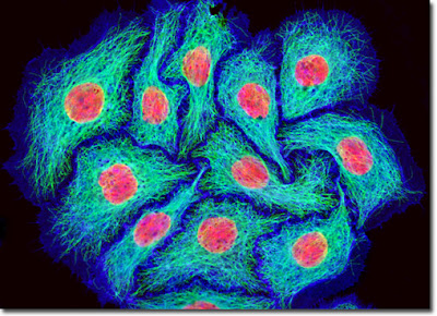 NGS: News on Genomic Studies: PubMed Highlight: the genome of HeLa cell ...