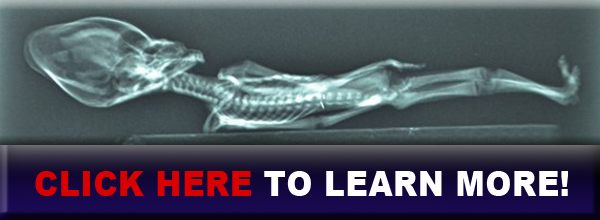 UFO's And STARPEOPLE (Aliens): The Atacama Humanoid Disclosure