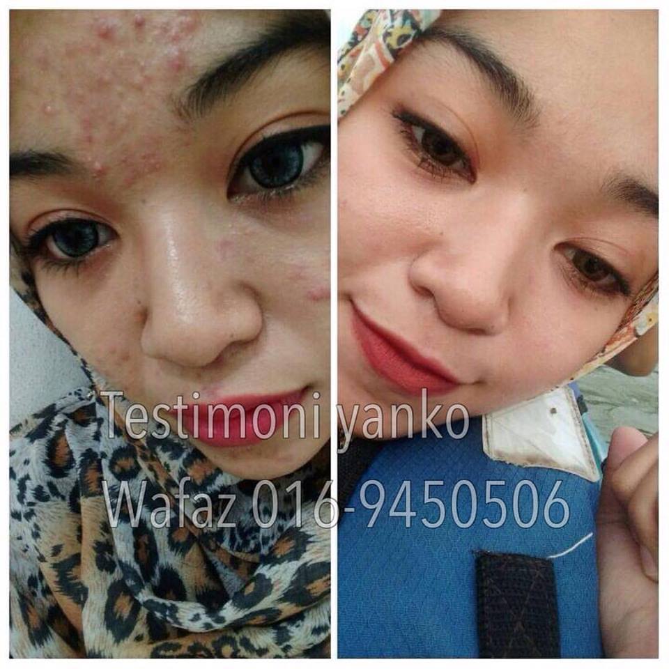 Natural Health Be Young: TESTIMONI YANKO SKINCARE