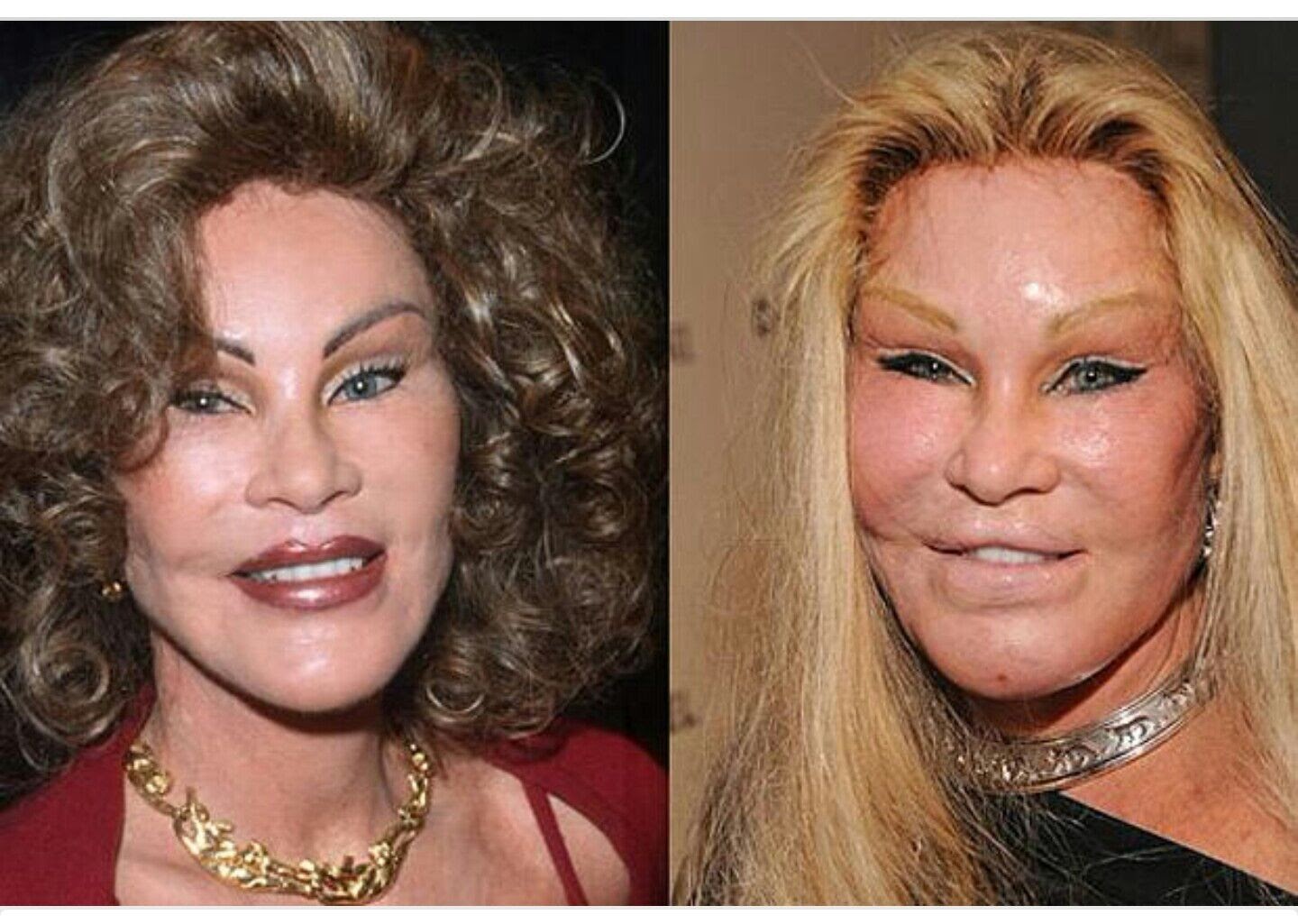 TECNOLOGIAS Y NOVEDAD MUNDIAL: Que Horror !!! Fails de Cirugias ...