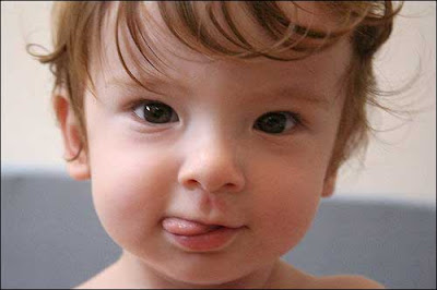 The Upper Cervical Blog: Upper Cervical Care Helps One Year Old With ...