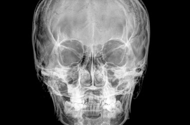 Producción y Tratamiento de Imágenes Diagnósticas: PROYECCIONES ...