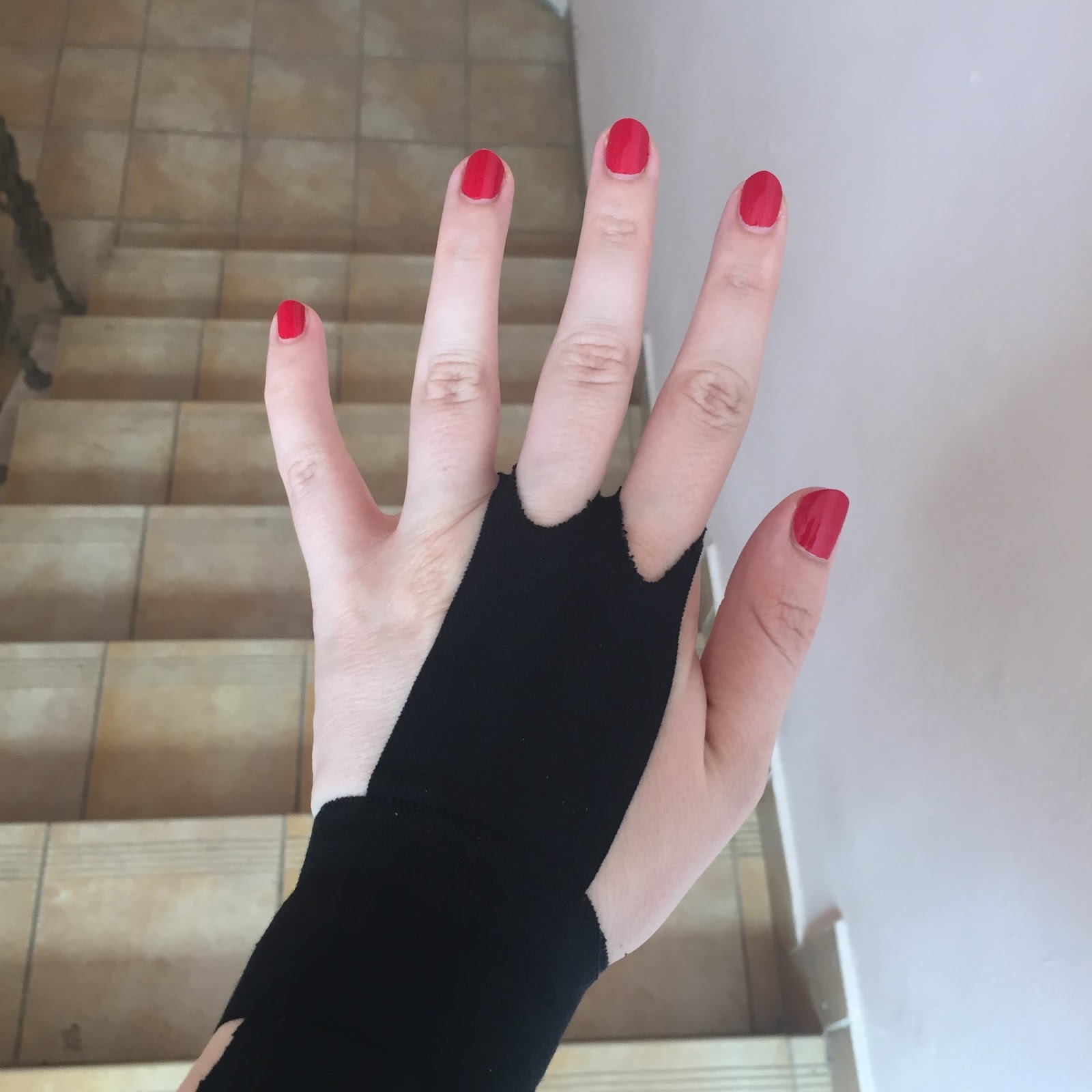 Anna Ananasová: Zánět šlach aka mám v paži