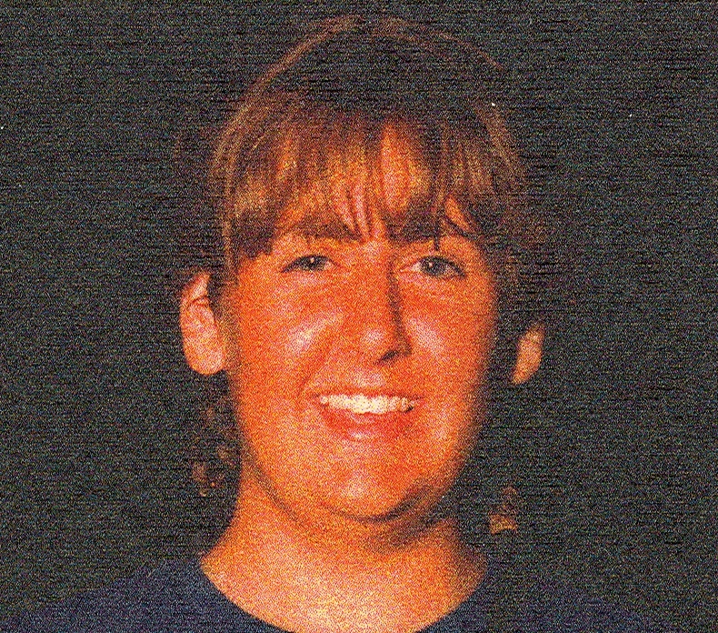 Genes That Don't Fit!: Downward Slanting Eyes Can Be A Marker In Ehlers ...