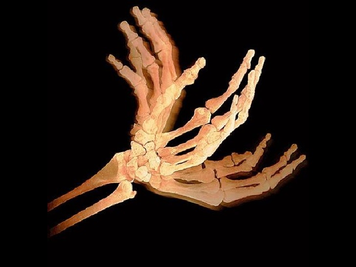 CMI Biología 3º ESO: T-5 La relación. Los sentidos y el sistema ...