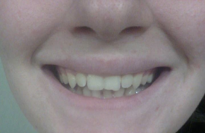 Marsha's Spot: COLGATE® OPTIC WHITE® INTRODUCES THREE NEW PRODUCTS FOR ...