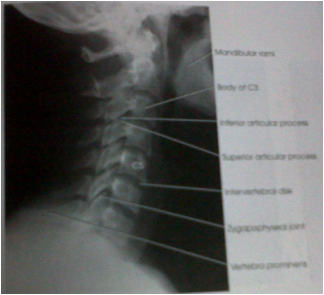 Radiografi C.V Cervicalis