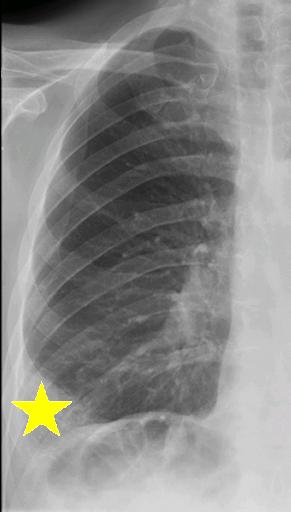 ABC Radiology Blog: 07/01/2012 - 08/01/2012