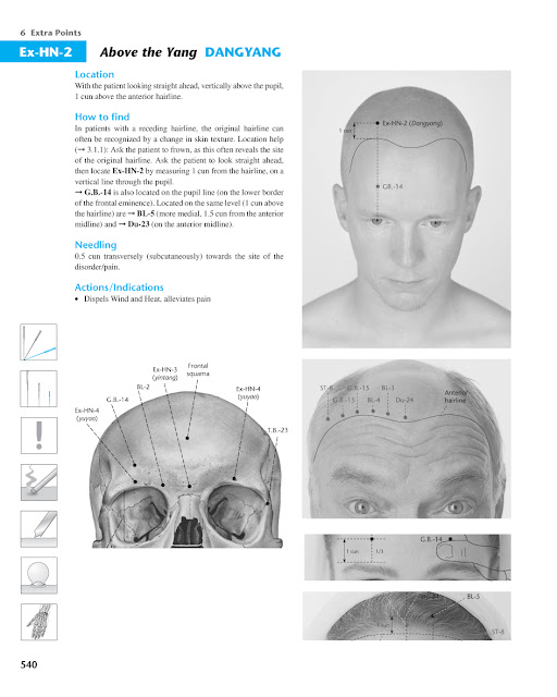 Acupuncture Masters: Acupuncture Points Database - Extra Points