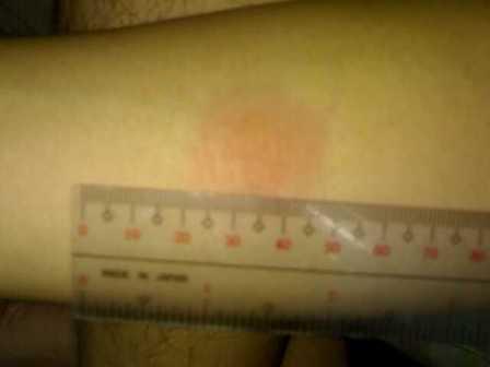 Life's Uncertainties: Worrisome PPD