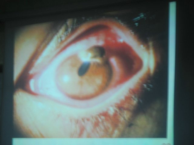 OSPE - Department Of Eye - Rawalpindi Medical College - 2010 ~ YOUNG ...