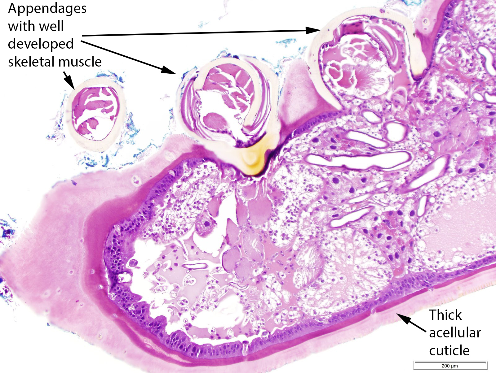 Creepy Dreadful Wonderful Parasites: Answer to Case 253