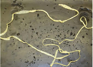 Bacteritullitas De Pasteur: TENIA : WOW