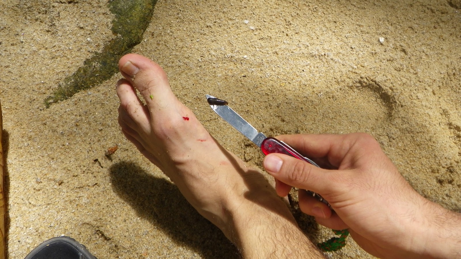 Survival Guide for Expat Aid Workers: How to remove a leech
