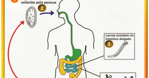 Verminoses: Oxiurose