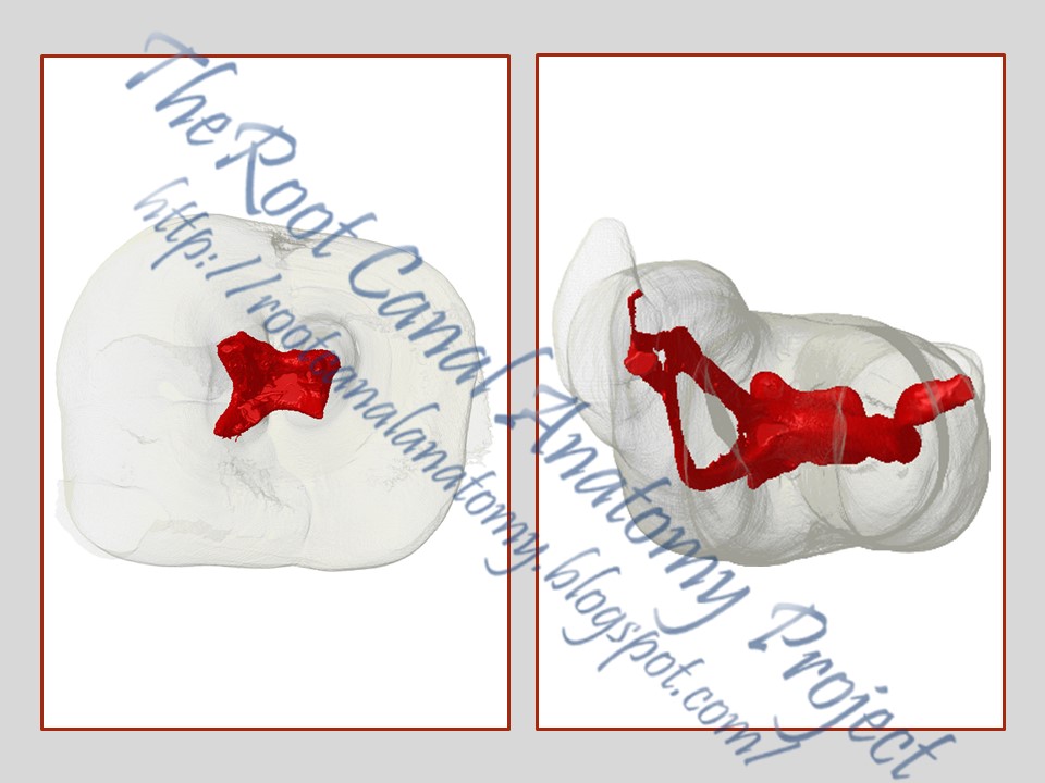 The Root Canal Anatomy Project: Mandibular First Molar