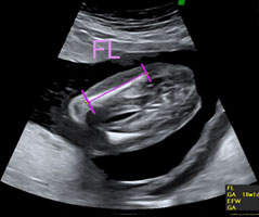 First Choice Baby Scan: 19 Weeks pregnant