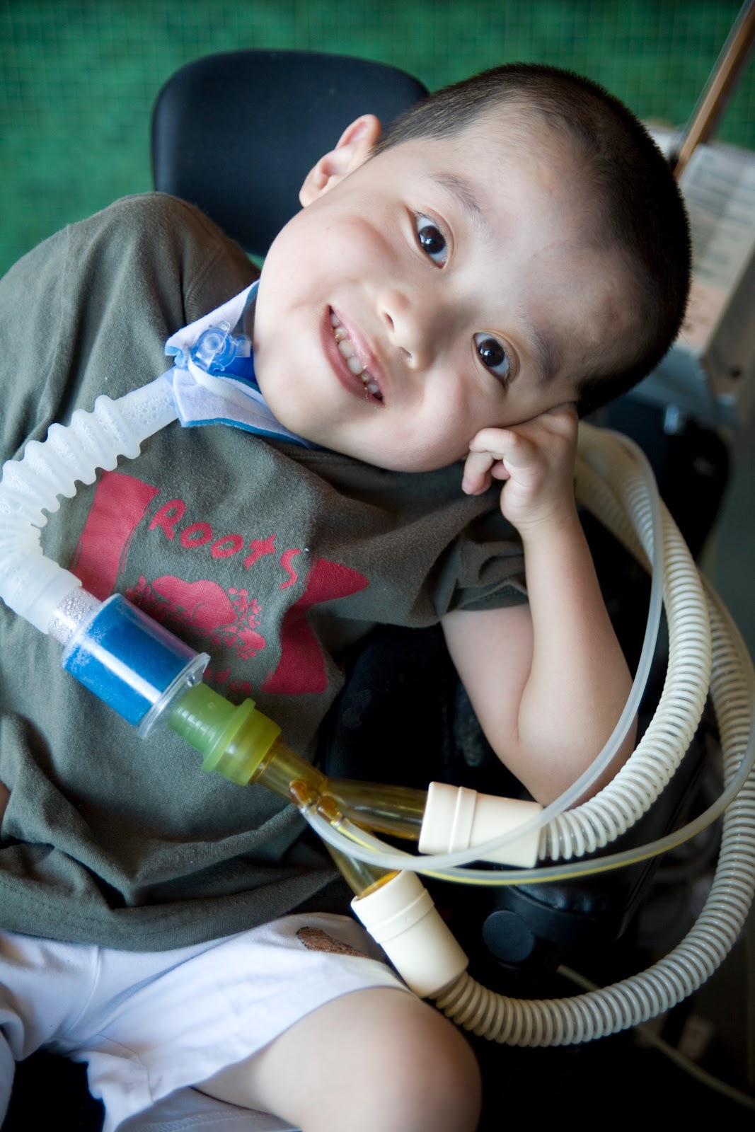 excitedabouteducation2014: severe and multiple disabilities: Intervention