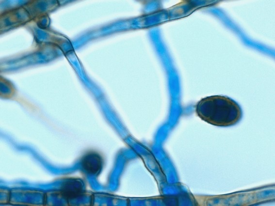 Fun With Microbiology (What's Buggin' You?): July 2015