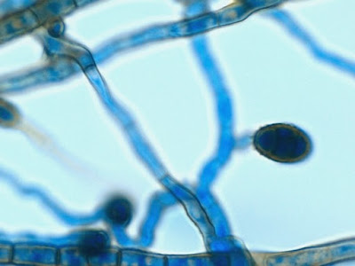 Fun With Microbiology (What's Buggin' You?): Pithomyces species