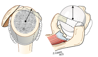 UW Shoulder and Elbow Academy: What is pseudoparalysis, anyway?
