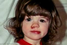 OFFICIAL ENCIKSERAM: Manusia yang dilahirkan tidak mempunyai rasa sakit